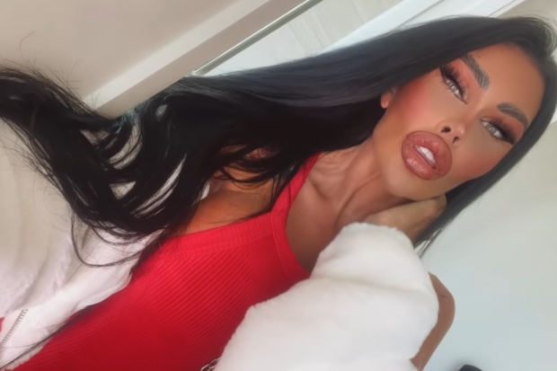 130.000 Euro für Schönheits-OPs ausgegeben: Und SO sah Tara Jayne vorher aus